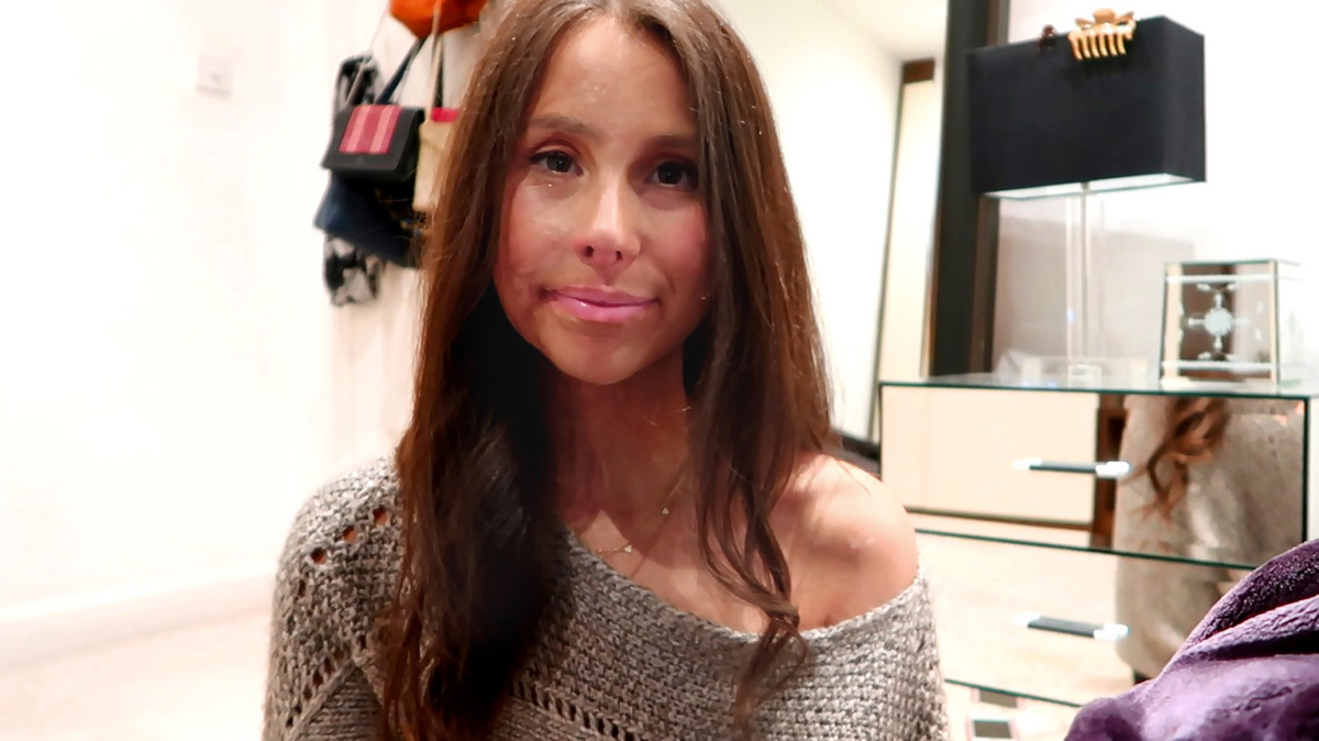 Katie Gee survived an acid attack, now she wants to change our view of ...